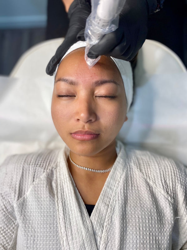 Dermapen Skin Needling Moonee Ponds | Microneedling | ELIIXA